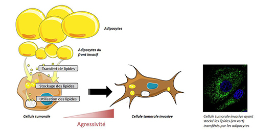 Les cellules graisseuses situées à proximité des cancers du sein ...